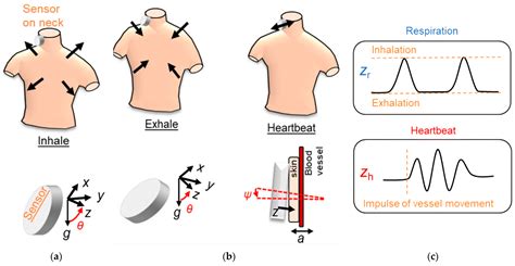 Electronics Free Full Text An Overview Of Wearable Piezoresistive And Inertial Sensors For