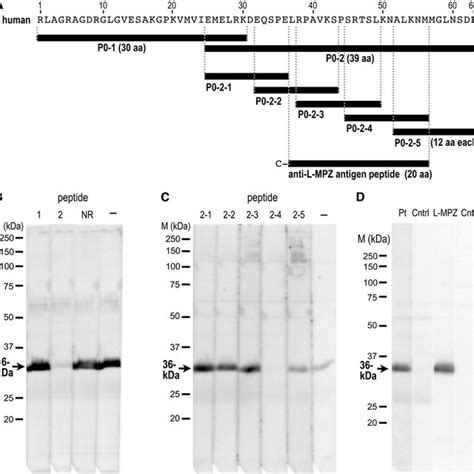 Characterization Of The 36 Kda Protein Detected By The Serum Igg Of A Download Scientific