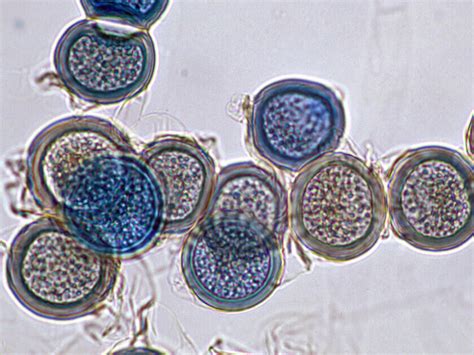 Basidiobolus Ranarum Mycology University Of Adelaide