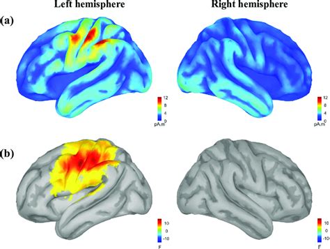 Estimated Source Activations In Response To Vibrotactile Stimulations Download Scientific