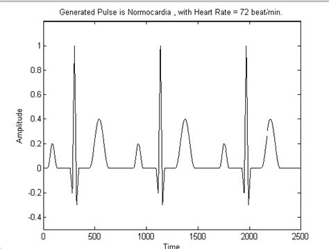 Figure 1 From Arrhythmia Detection Using Wavelet Transform Semantic