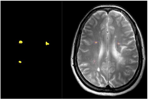 Optimal Integration Of Machine Learning For Distinct Classification And Activity State