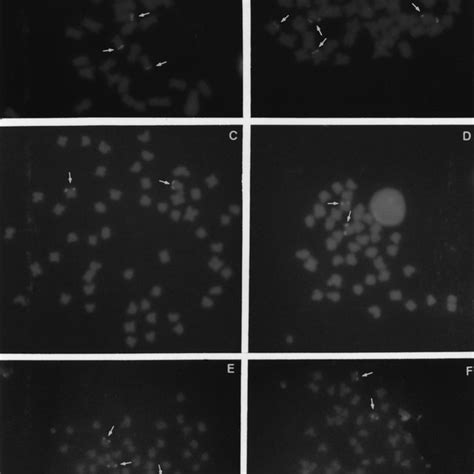 Fluorescence In Situ Hybridization With Biotin Labeled 18s Rdna Probe