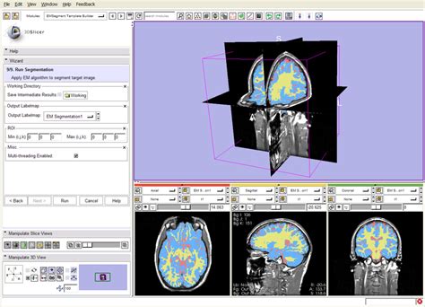 modules emsegment templatebuilder 3 4 slicer wiki