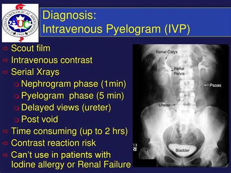 Canadian Undergraduate Urology Curriculum Canuuc Urinary Calculus Disease Last Revised By Dr
