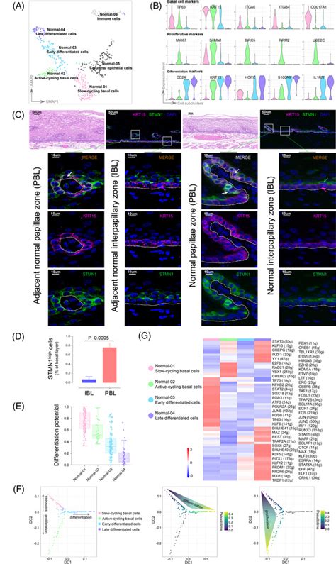Single‐cell Transcriptomics Provides Insights Into The Origin And Microenvironment Of Human