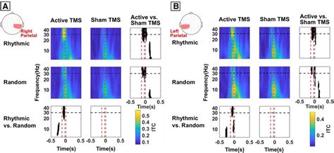 Causal Modulation Of Right Hemisphere Fronto Parietal Phase Synchrony
