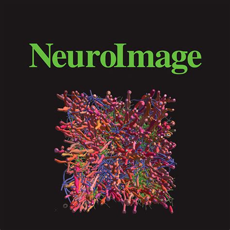 The Open EEGLAB Portal Interface High Performance Computing With EEGLAB IONS