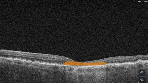 Oct Optometry