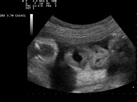 Illegal In India To Know A Baby S Sex Before Birth Snopes Com