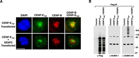 Sumo 23 Modification And Binding Regulate The Association Of Cenp E With Kinetochores And