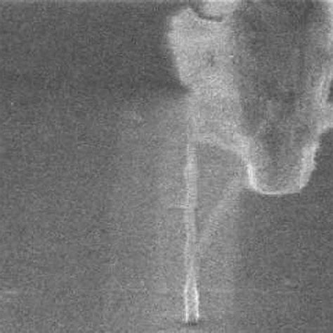 Nanoassembly Youtube