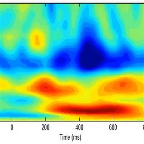 Time Frequency Representation Of EEG For Sleep Stage Classification