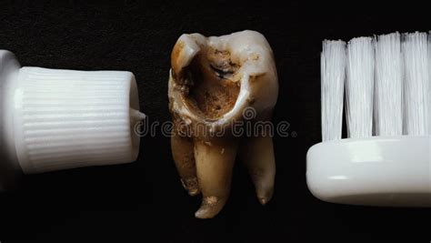 Macro Shot Of A Decayed Teeth Till Root After Extraction Of Dentist