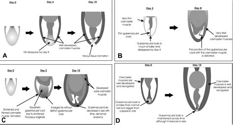 The Anatomy Of The Cremaster Muscle During Inguinoscrotal Testicular