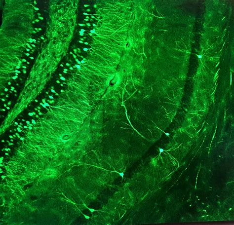 Neuronal Localization Of Genetically Encoded Voltage Indicators