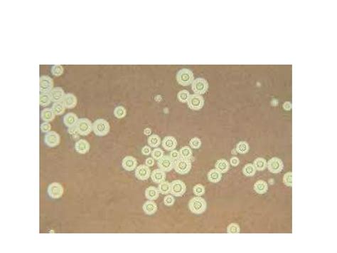 Cryptococcus Pptx