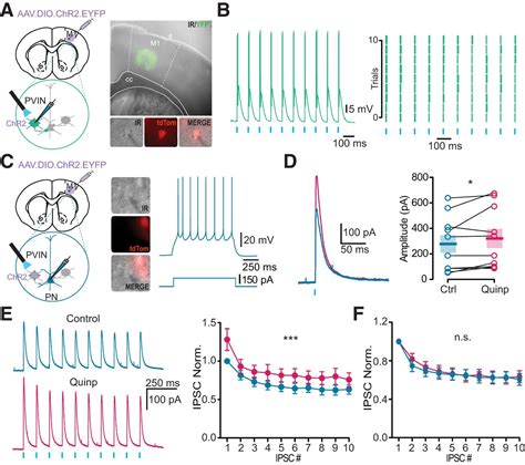 Dopamine D2 Like Receptors Modulate Intrinsic Properties And Synaptic Transmission Of