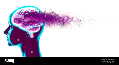 Memory Lapses Forgetting Things Degenerative Disease Brain Problems Parkinson And Alzheimer