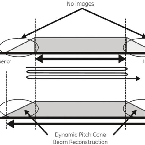 There Is No Overscanning With Volume Helical Shuttle Top Conversely