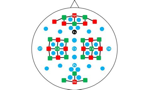 Open Access Dataset For Eegnirs Single Trial Classification Transactions On Neural Systems