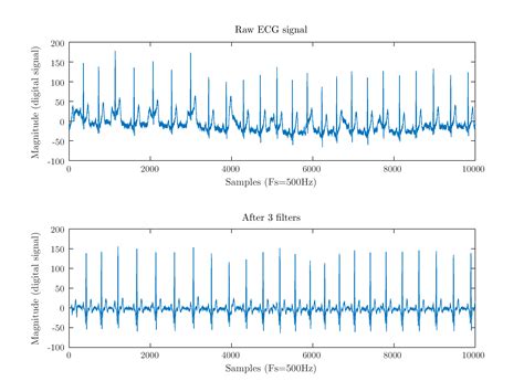 Ecg Filter Lab Mee Labs