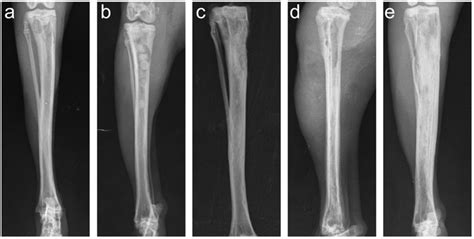 Radiographic Images Showing A Experimental Osteomyelitis In Rabbit Download Scientific