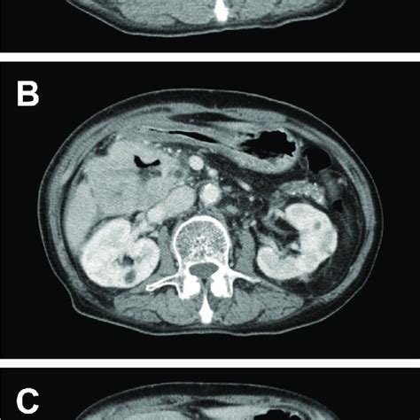 Nih Fletcher Criteria For Gist Risk Assessment Download Table