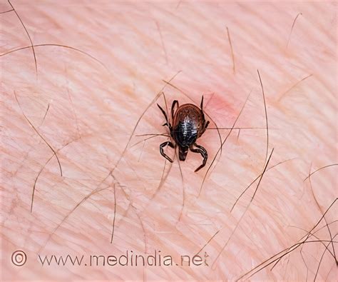 How Genetics Could Turn The Tide On Lyme Disease