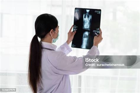 병원실에서 환자의 엑스레이 필름에서 검사하는 여성 방사선사 폐 방사선 촬영 개념 X 레이에 대한 스톡 사진 및 기타 이미지 X 레이 건강 진단 건강관리와 의술