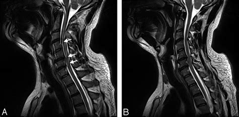 Blade Sequence During 2 Types Of Brief Head Motion A B In A