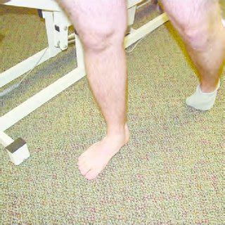 Palpation Of The Iliac Crest To Examine For Pelvis Height Higher Iliac Download Scientific