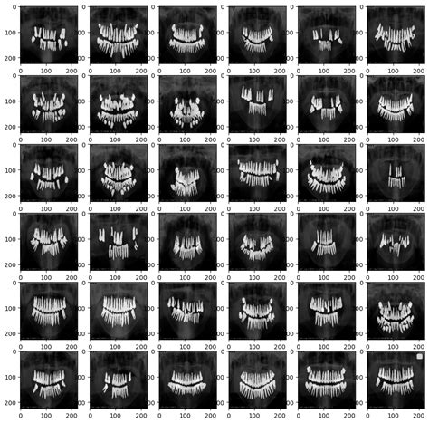 github kaledhoshme123 adult tooth segmentation u net based gan