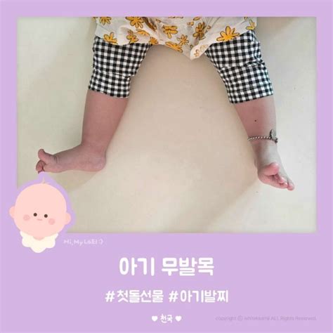 아기 무발목 첫돌선물 추천 아기 미아방지 발찌 네이버 블로그