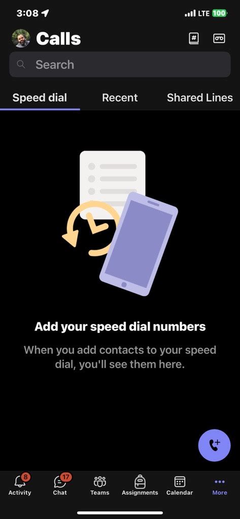 Microsoft Teams Phone Innovation And Babe Choice