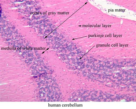 Otoliths Histology