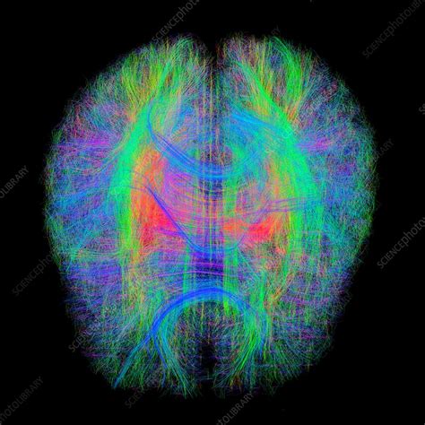 White Matter Fibres Of The Human Brain Stock Image C0342038