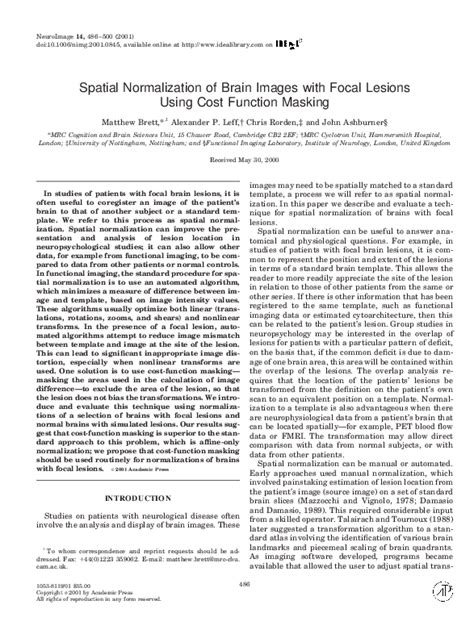 Pdf Spatial Normalization Of Brain Images With Focal Lesions Using Cost Function Masking
