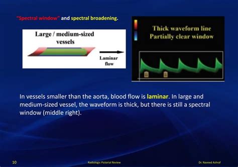 Doppler Ultrasound In Peripheral Arterial Disease Pdf Heart And Cardiovascular Diseases