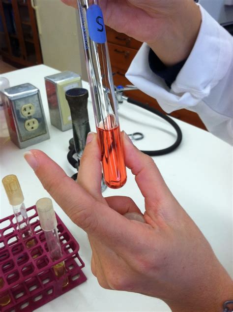 Rose Lindsey S Medical Microbiology Blog Testing For Sucrose Glucose And Lactose