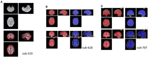 a functional mri pre processing and quality control protocol based on