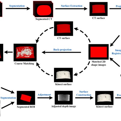 The Workflow Of The Proposed Markerless Registration Method Download Scientific Diagram