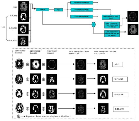 Figure 1 From Multimodal Medical Image Fusion Using Two Stage Decomposition Technique To