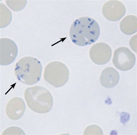 Erythrocyte Production And Destruction Flashcards Quizlet