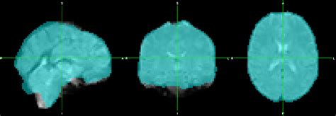 fmriprep v24 0 1 brain masking question fmriprep neurostars