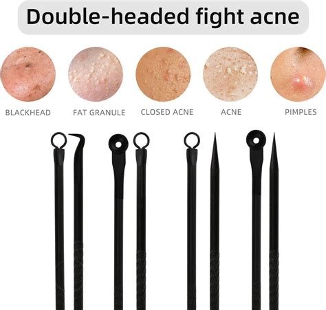 Duduer Blackhead Remover Pimple Popper Tool Kit For Acne Extraction On