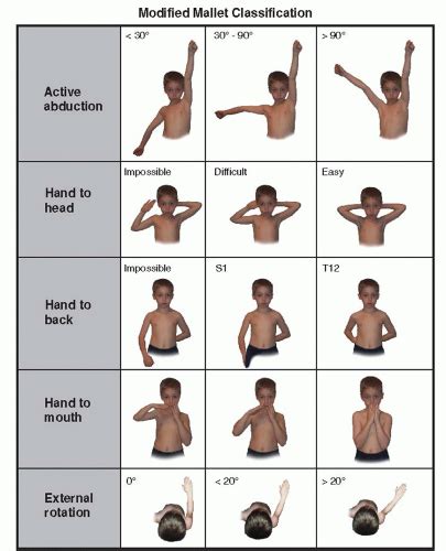 Brachial Plexus Birth Palsy Shoulder Reconstruction Musculoskeletal Key