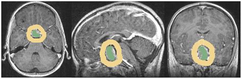 These Images Present A Typical User Initialization For Pituitary Download Scientific Diagram