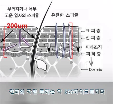 스피큘에 대한 Faq 상세설명