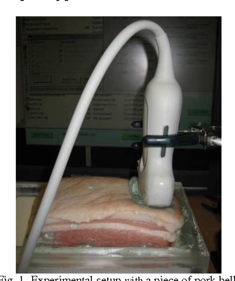 Figure 1 From Phase Aberration In Shear Wave Dispersion Ultrasound Vibrometry Semantic Scholar